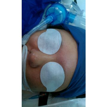 Bulk Buy China Wholesale Medical Eye Shields, During General Anesthesia ...