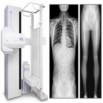 Scan Digital Radiography (DR) X-ray for Full Spine and Long Bone ...