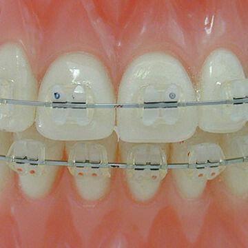 Composite Bracket, Made of Polycarbonate, with Reinforced Fiberglass ...