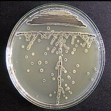 Baird-parker Agar,base | Global Sources