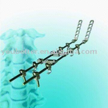 Buy Wholesale China Hot! Posterior Cervical Screws&rods System Implant ...