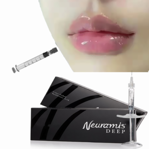 Korea Neuramis deep volum fine Dermal Filler for lip Hyaluronic acid ...