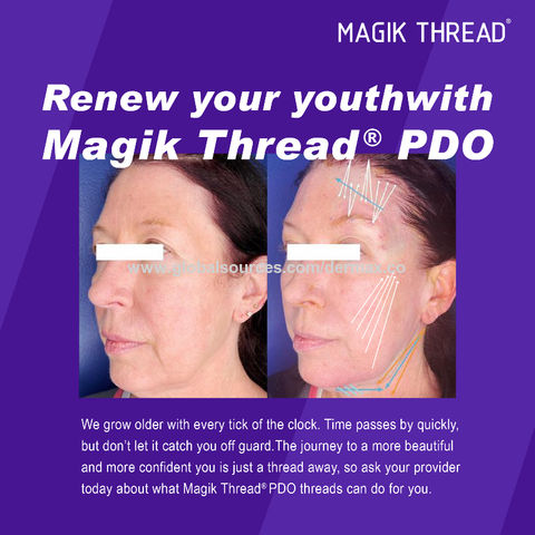 Buy Wholesale China Absorbable Lifting Thread Pdo 4d Cog Thread Lift ...