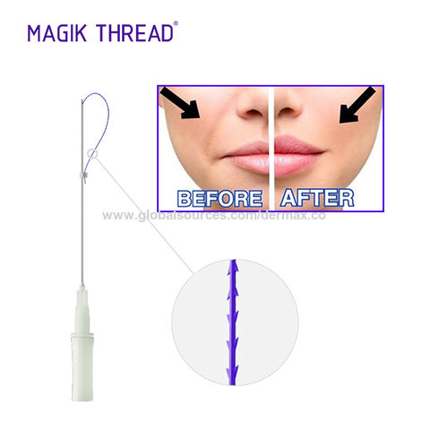 Manufacturers Brand Pdo Tread Mini Mono Screw Pdo Thread Lift for Eyes ...