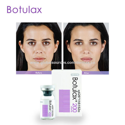 Buy Wholesale China Botulax 100 200 Units Butolax Nabota 100u Korea ...