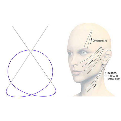 Buy Wholesale China Ce Approved Korea Beauty Hilos B Tip 20g 280mm ...