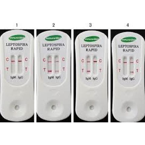 Buy Wholesale United States Rapid Diagnostic Testing For S-a-r-s-c-o-v ...