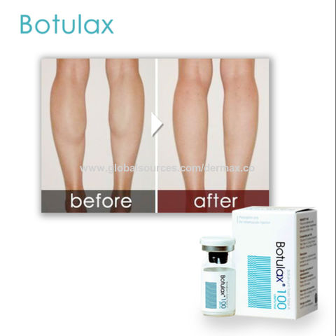 Buy Wholesale China Botoxin 100u 200u Toxine Powder Injection Botox ...