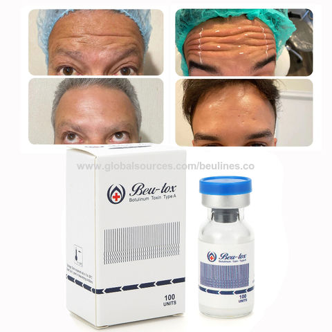 Buy Wholesale China Botox Injection Innotoxs Botox Estet Compar ...