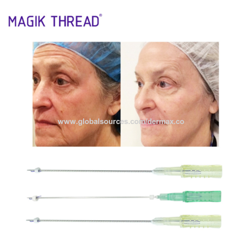 Buy Wholesale China Magik Thread Absorbable Suture Thread Lift Mono Smooth Pdo Thread Under Eyes ...