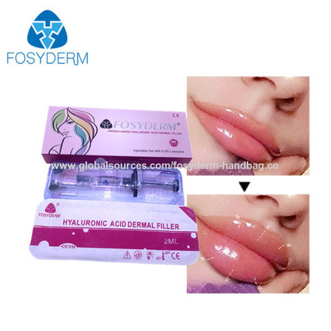 Buy Wholesale China Dermal Filler Cross Linked Hyaluronic Acid ...