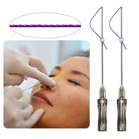 Buy Wholesale China Korea Manufacturer Price Nose Lifting Barbed Pdo ...