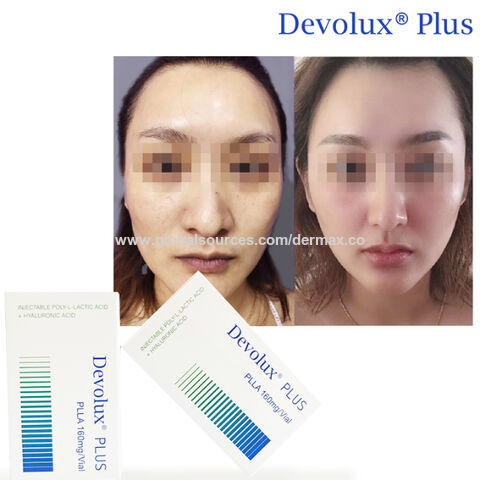 Buy Wholesale China Devolux Plla Filler Korea Aesthetic Sculptra Poly L ...