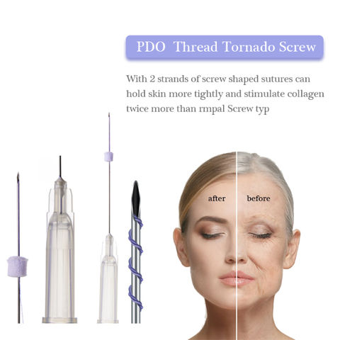 Buy Wholesale China Best Hyaluronate Acid Suture Needle Thread Lift ...