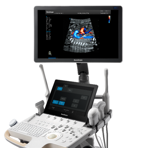 Medical Digital Diagnostic Ultrasound Machine S60 Doppler Ultrasound ...