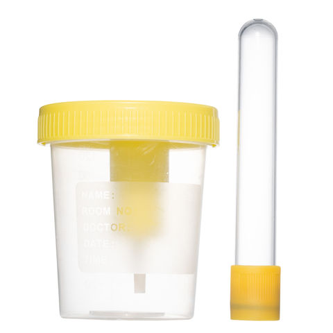 Buy Wholesale China Sterile 120ml Vacuum Urine Sample Collection Cup ...