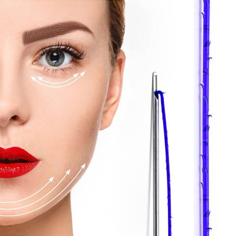 Buy Wholesale China Korean Fine Suture Threading Ultra V Facial Screw ...