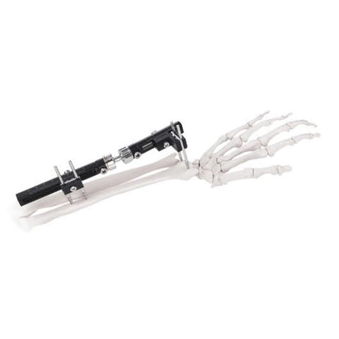 Buy Wholesale China Orthopedic External Fixation External Fixator Aoye ...