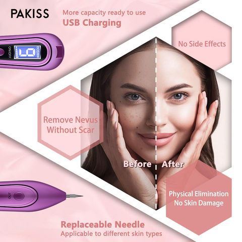 Buy Wholesale China Manufacturer Oem Fy-104 Remove Dot Dark Spot Fat ...