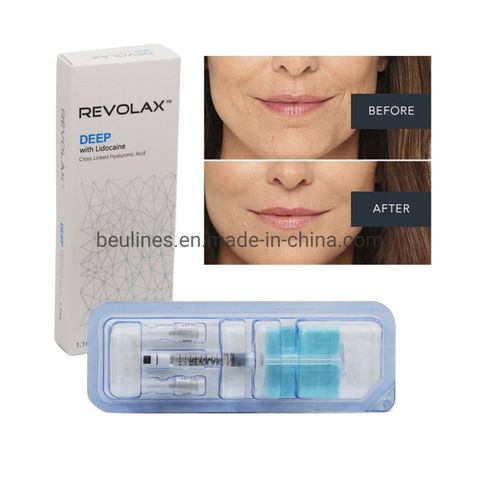 Buy Wholesale China Revolaxs Teosyals Nasolabial Lines 1.1ml Volbella ...