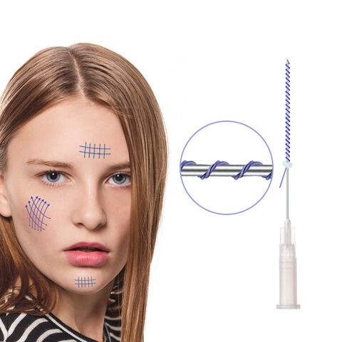 Buy Wholesale China Magic Face Lift Needle Polydioxanone Silk Suture ...