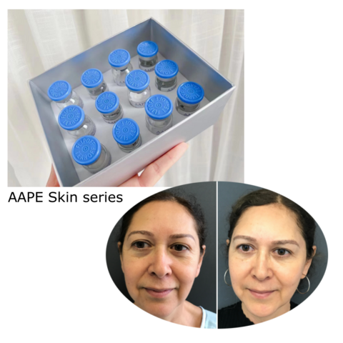 Buy Wholesale China Fda Aape Stem Cell For Skin Anti-aging Whitening ...