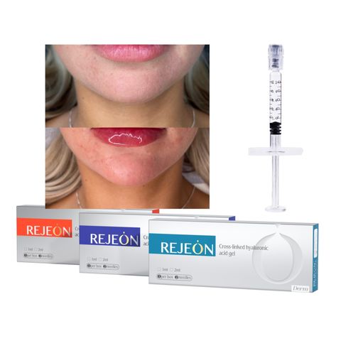Buy Wholesale China Rejeon Ha Filler Injection Chin Injection Lip ...