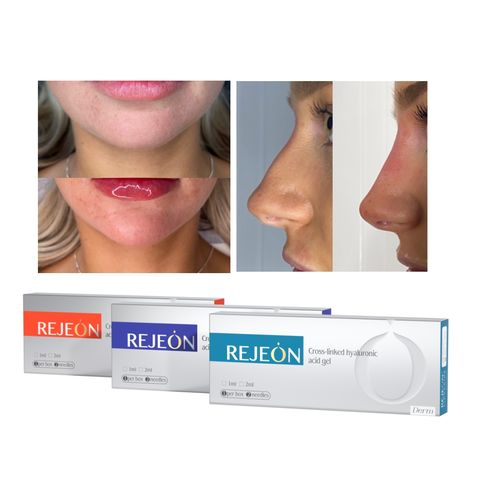 Buy Wholesale China Rejeon Dermal Filler Chin Injection Hyaluronic Acid ...