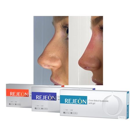 Buy Wholesale China Nose Reshaping Injecting Rejeon 2ml Deep Filler ...