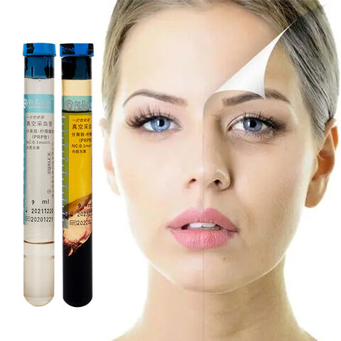 Buy Wholesale China Longtime Prp Vacutainer Plasma Separation Tubes ...