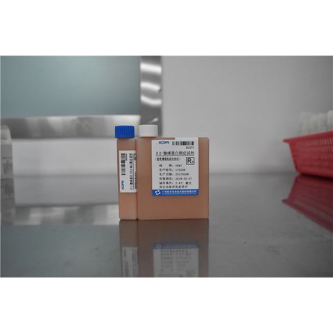 Buy Wholesale China β2-mg Reagent Kit (latex-enhanced ...