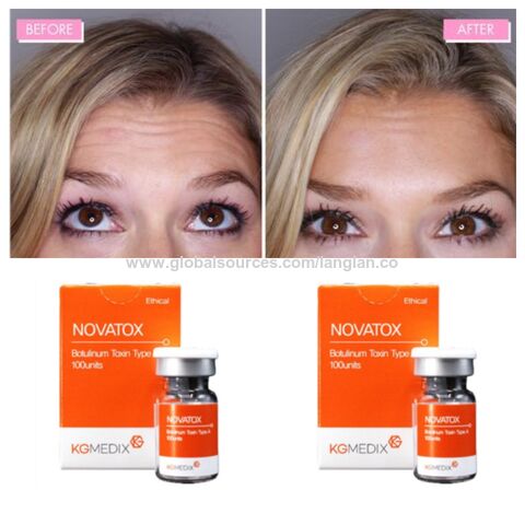 Buy Wholesale China Korea Botox Type A Novatox 100u Botulinum Toxina ...