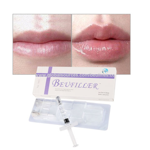 Buy Wholesale China Lip Injections Hyaluron Pen Lips Lip Augmentation ...