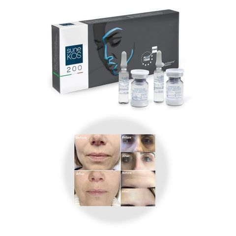 Buy Wholesale China Sunekos Injectable 200 1200 Hyaluronic Acid Filler ...