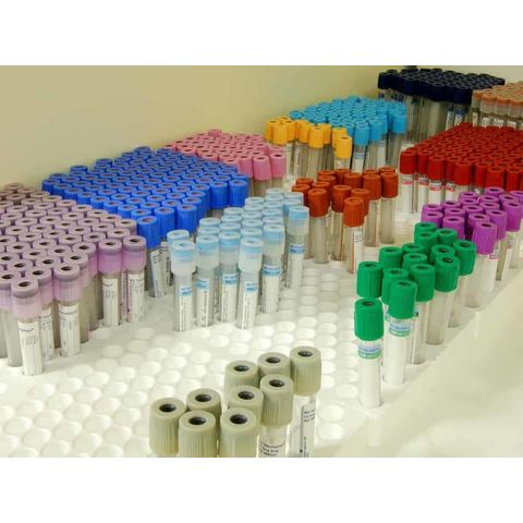 Buy Wholesale China K2 K3 Red Disposable Blood Sample Vacuum Blood ...