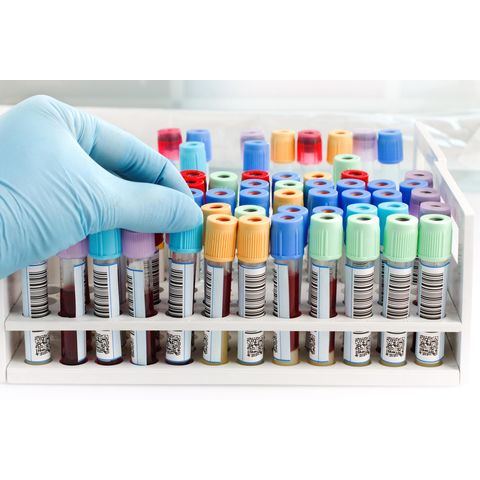 Buy Wholesale China Disposable Blood Sample Vacuum Blood Collection ...