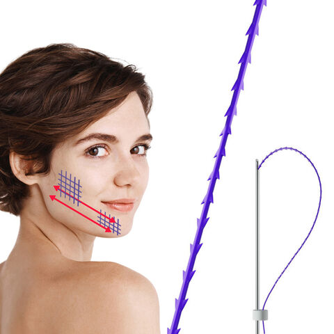 Buy Wholesale China High Quality Absorbable Pdo Cog Lifting Thread ...