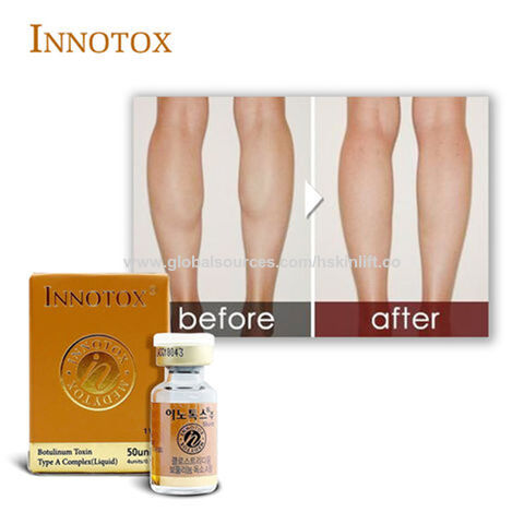 Buy Wholesale China 100 Units Inotox New Liquid Phase Type A 50u 100u ...