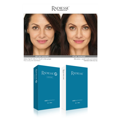 Buy Wholesale China 2023 Ready Stock Ce Fda Approval Radiesse ...