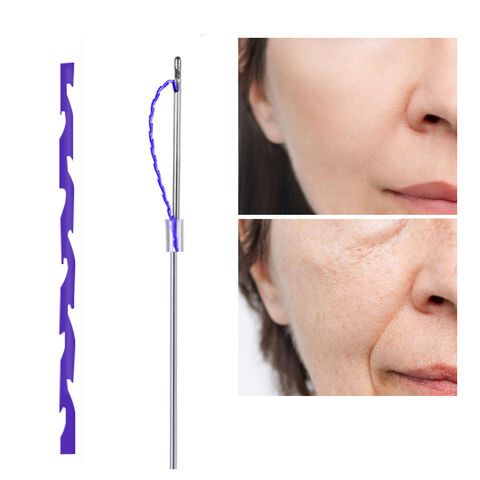 Buy Wholesale China High Quality Pdo Thread Face Lifting Hot Sale Best ...