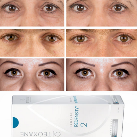 Buy Wholesale China Teosyal Redensity 2 Puresense (2x1ml) Teoxane Under ...