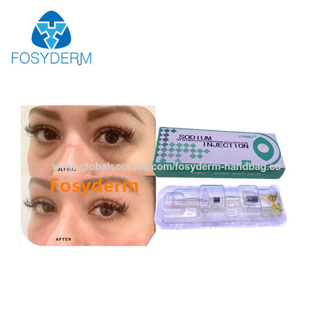 Buy Wholesale China Best Price 1ml Under Eyes Filler Sodium Hyaluronate ...