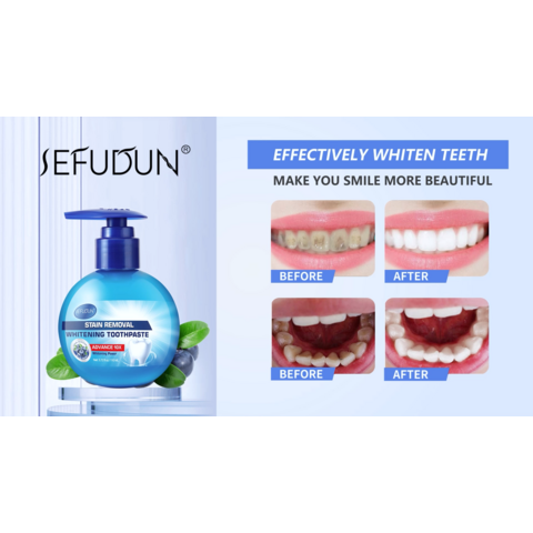 Buy Wholesale China Oem Obm Sefudun Toothpaste Intense Stain Whitening ...