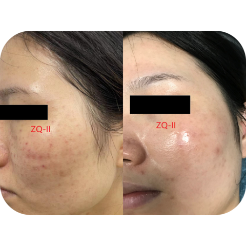 Buy Wholesale China Sodium Dna Serum Wholesale Manufacturer For Medical ...