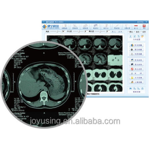 Buy Wholesale China Hospital Equipment 16.0mega Pixel Ct Film Scanner ...