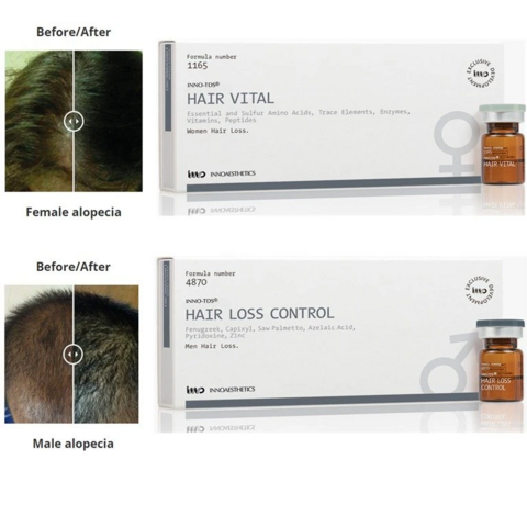 Buy Wholesale China Scm Haircare Booster Efficient Hair Growth Stem ...