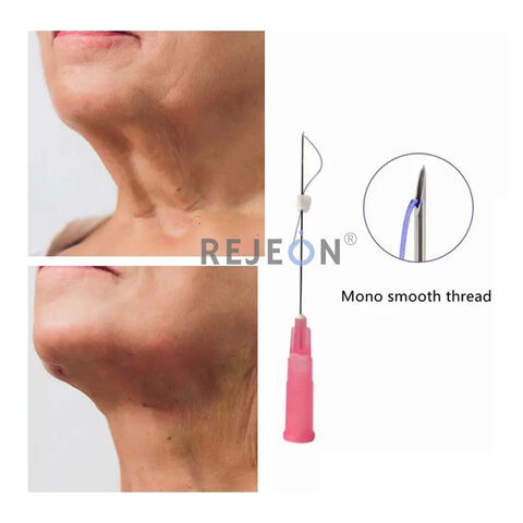 Buy Wholesale China More Lifting Neck Pdo Thread Nose Korea Pdo Thread ...