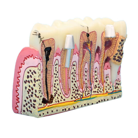 Factory Direct Standard Orthodontic Study Dentist Anatomical Oral ...