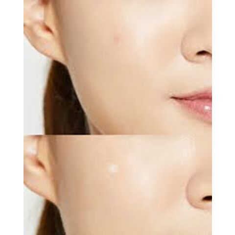 Hero Mighty Patch Original Hydrocolloid Acne Pimple Patches 36 Private ...