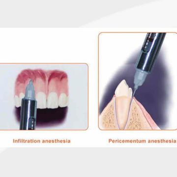 China Dental painless anesthesia instrument wireless local anesthesia ...